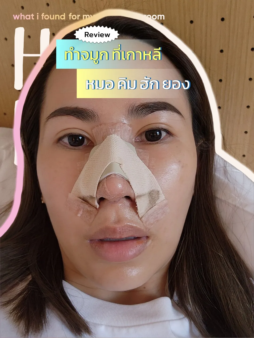 รีวิว ทำจมูกที่เกาหลี หมอคิมฮักยอง | แกลเลอรีที่โพสต์โดย Benz | Lemon8