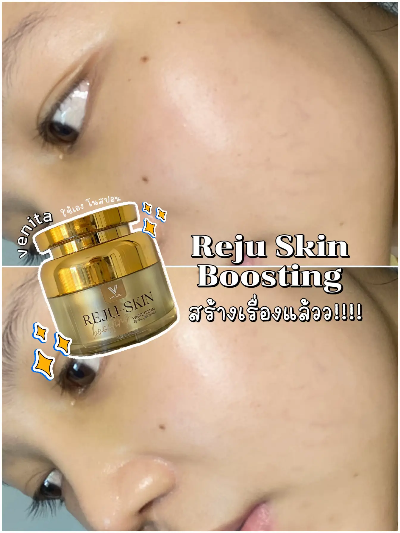 🪩-Review Reju Skin Boosting | Venita ครีมดังในตต. !! | แกลเลอรีที่โพสต์ ...