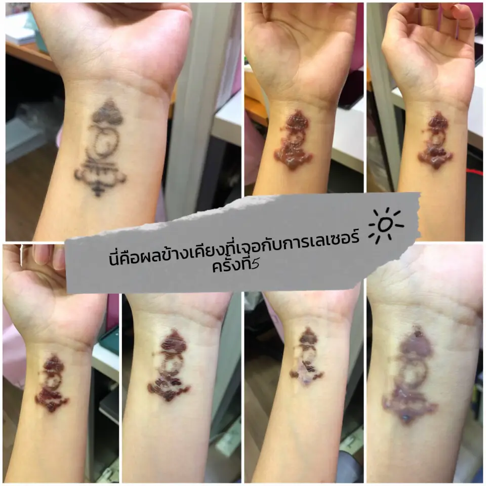 รีวิวกังนัมคลินิกสาขา Ics - การค้นหาใน Lemon8