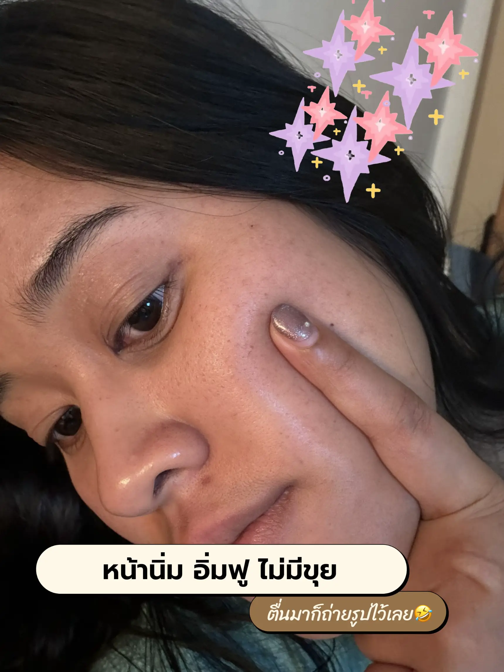 ครีมปิดผิว STARTER ONERNIGHT REPAIR 72 HOURS | แกลเลอรีที่โพสต์โดย Chorpor | Lemon8