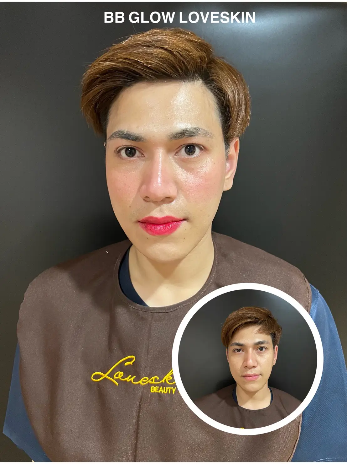 แชร์ประสบการณ์ ทำ BB Glow | แกลเลอรีที่โพสต์โดย Nambank | Lemon8