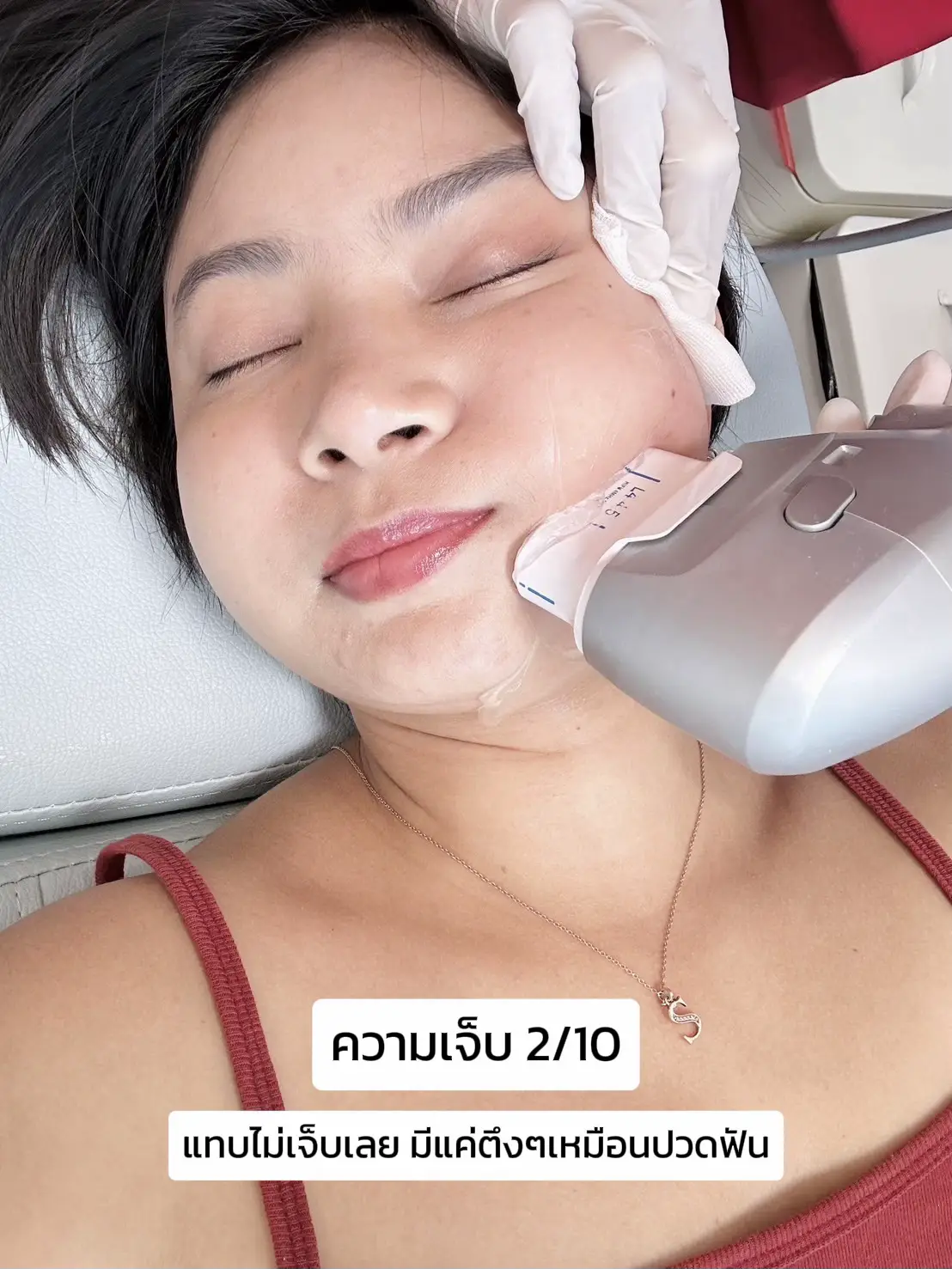 Premium Hifu สองแบ้งค์เทามีทอน เห็นผลจริง😱😱 | แกลเลอรีที่โพสต์โดย ตอเต่าป้ายยา💋👊🏻 | Lemon8