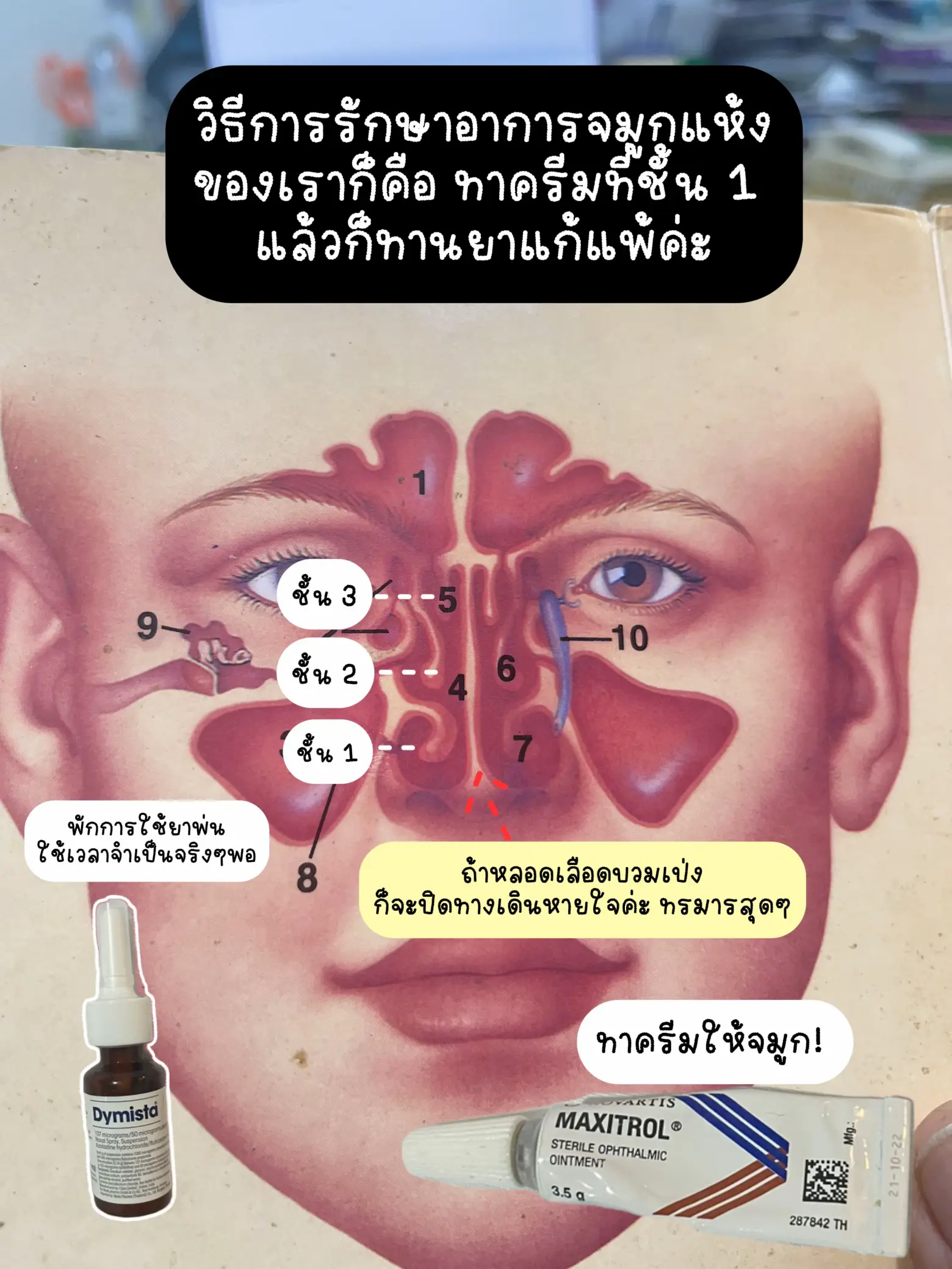 ลดบวม Proctase-P คือ ยา แก้ อะไร - การค้นหาใน Lemon8