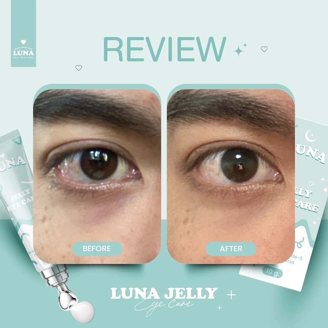 ครีมทาใต้ตาลูน่า Luna Jelly Eye Care | แกลเลอรีที่โพสต์โดย 𝐈𝐍𝐆𝐈𝐍𝐆 | Lemon8