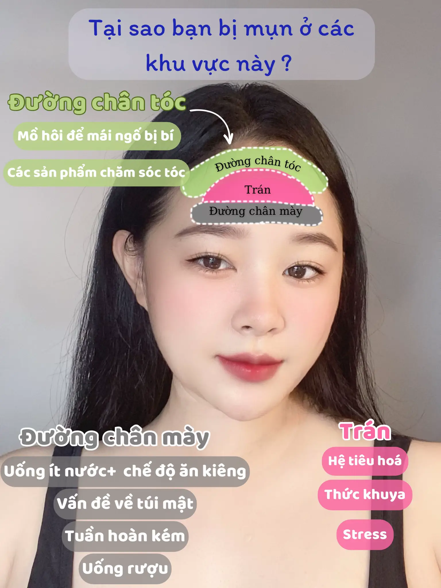 NGUYÊN NHÂN LÊN MỤN TỪNG VÙNG KHUÔN MẶT | Bộ sưu tập do Bảo Bối 🍀 đăng ...