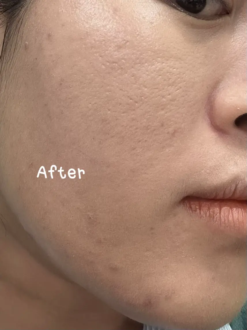 คุชชั่น pala | แกลเลอรีที่โพสต์โดย Fluke Fix | Lemon8