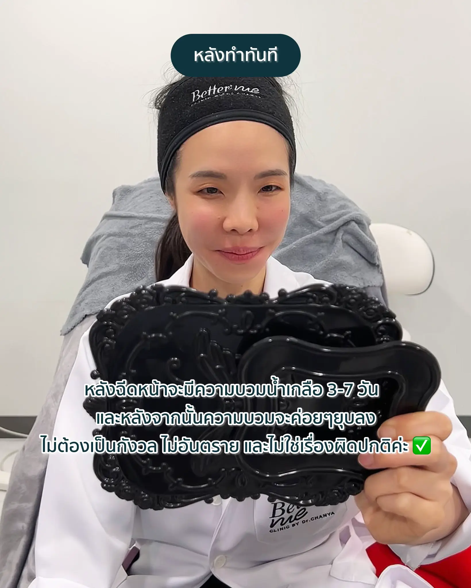 ข้อควรรู้ก่อนฉีด Radiesse | แกลเลอรีที่โพสต์โดย Dr.Chanya | Lemon8