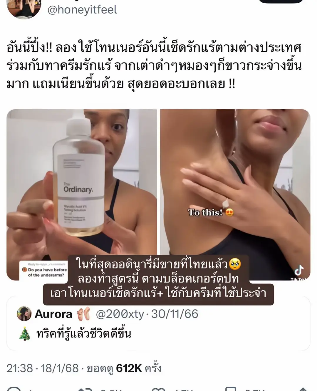 แชร์ประสบการณ์แพ้โรลออน รักแร้ดำมา 17 ปี | แกลเลอรีที่โพสต์โดย Kesinee.K | Lemon8