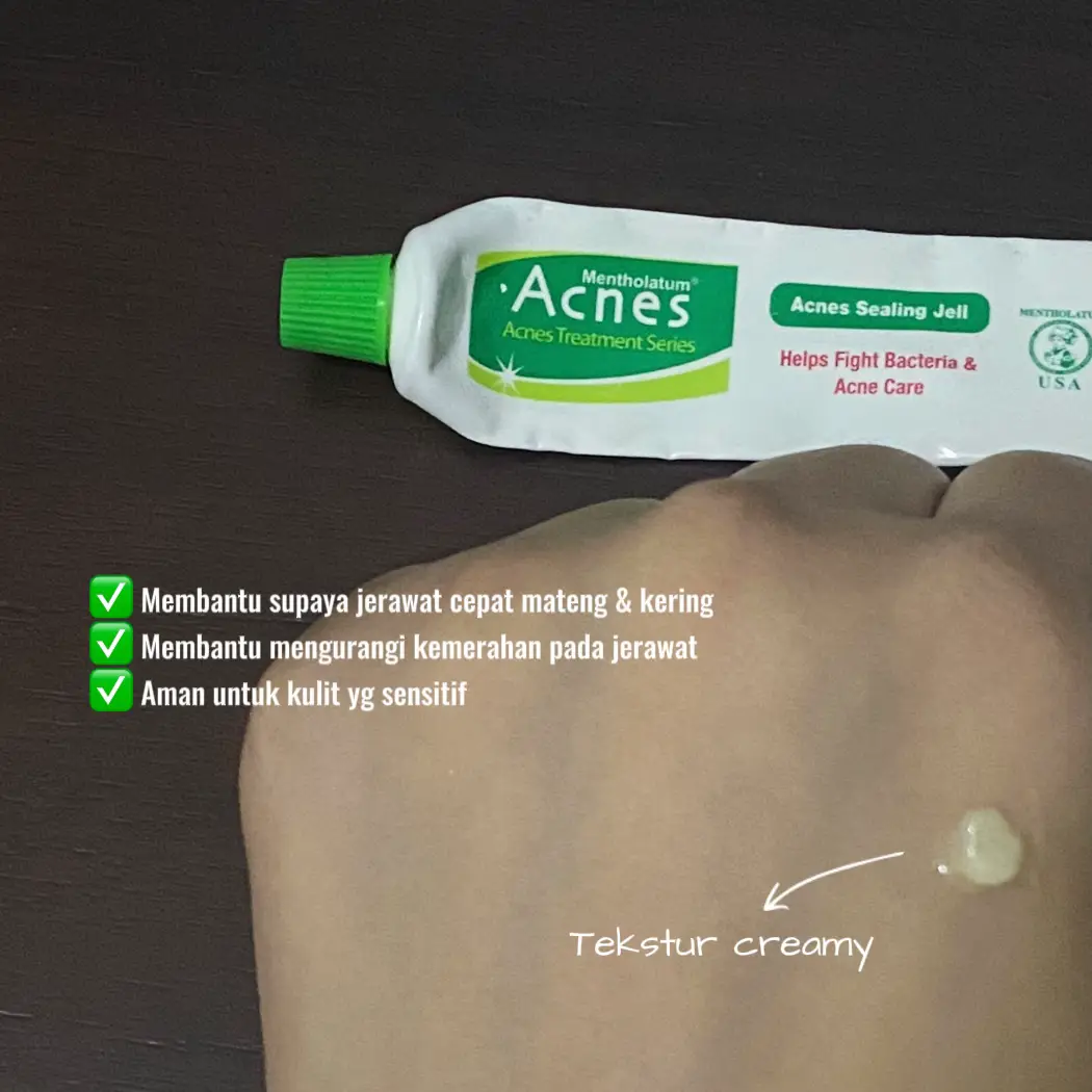Solusi jerawat yang on off | Galeri diposting oleh Risma Ayu | Lemon8