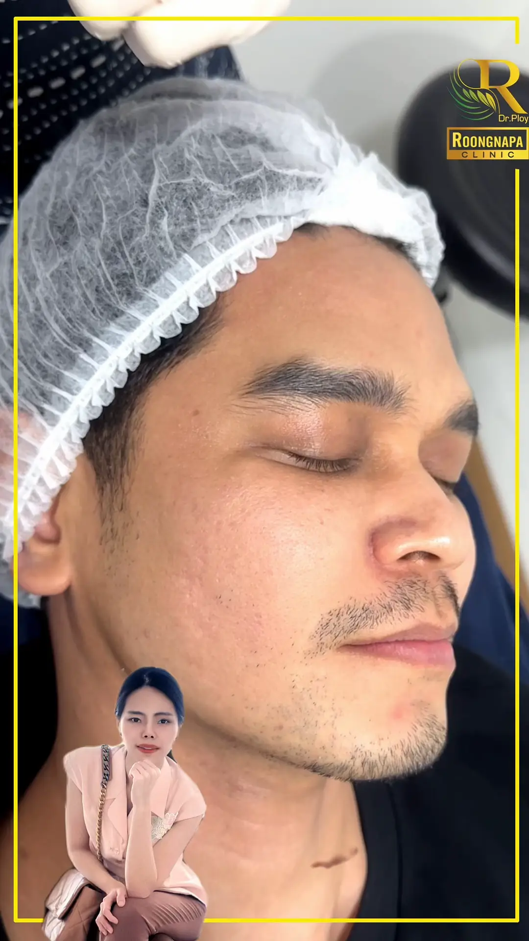 วิเคราะห์หลุมสิว | วิดีโอที่เผยแพร่โดย Dr.Ploy รุ่งนภา | Lemon8