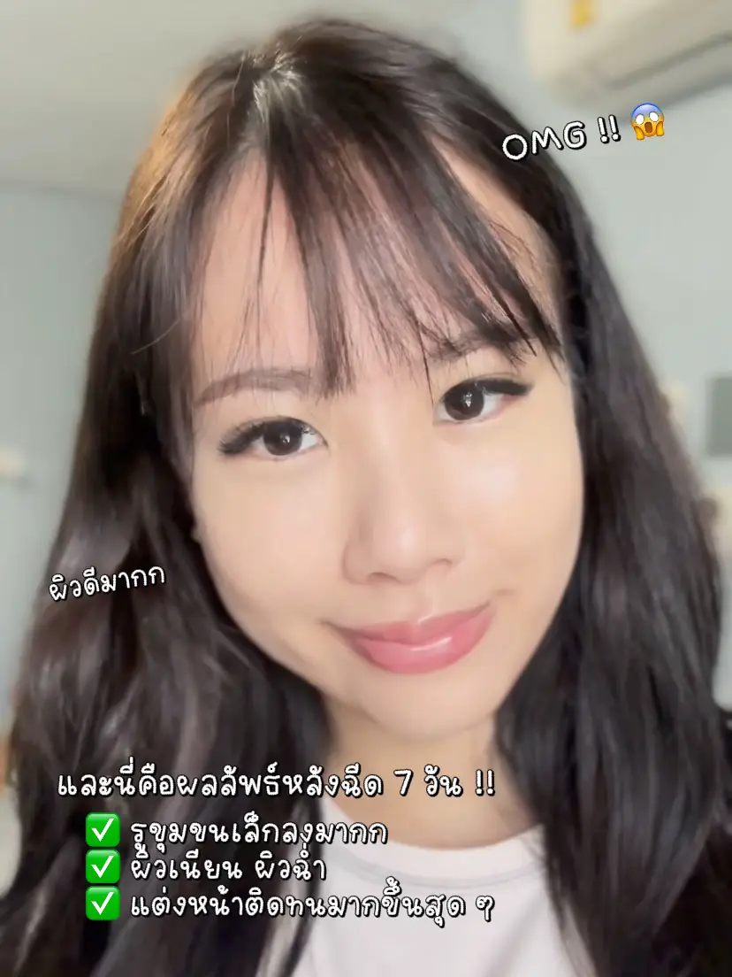 Juvelook, what is Korean skin work? 🤔 Injection and bang skin? 🤨 ...