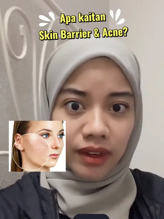 Skin Barrier and Acne | Video diterbitkan oleh NIHON Skin | Lemon8