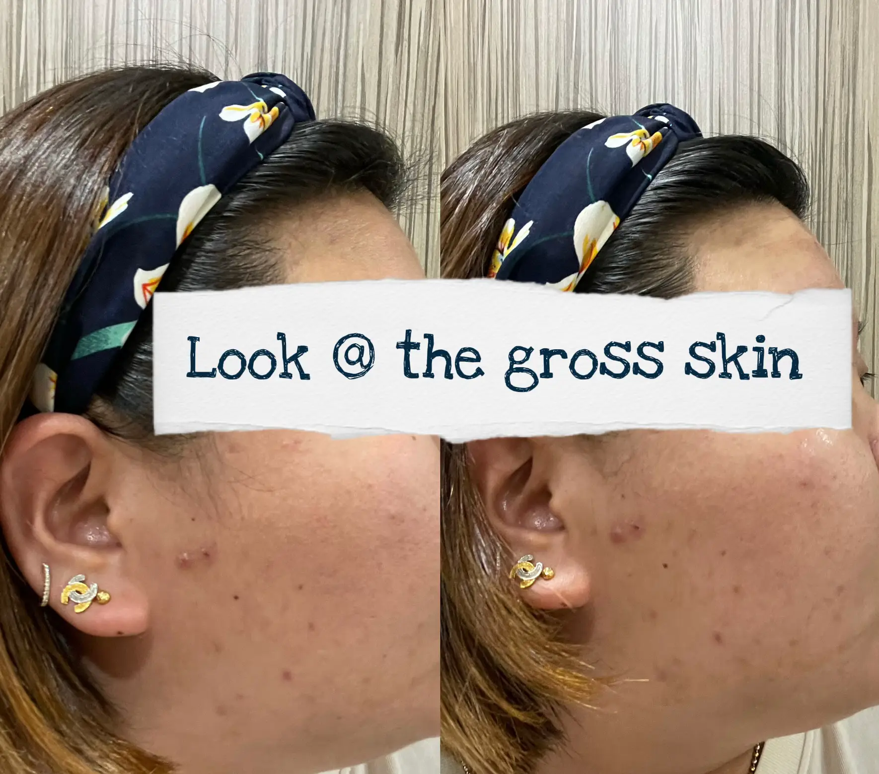 Chalamx - Lemon8 Search