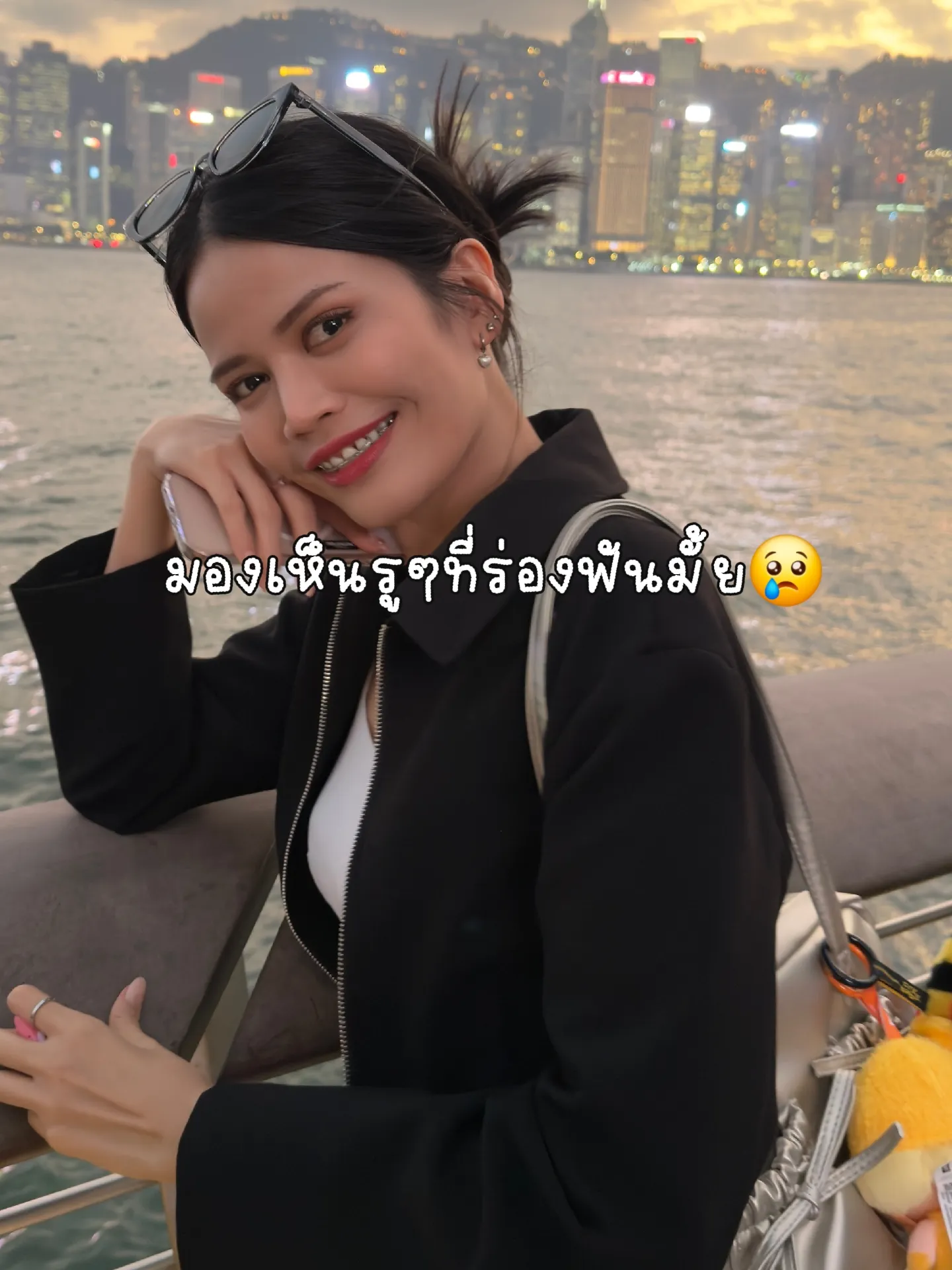 รีวิว จัดฟัน ฉบับคนถอนออก 6 ซี่ | แกลเลอรีที่โพสต์โดย Vila’s Story | Lemon8