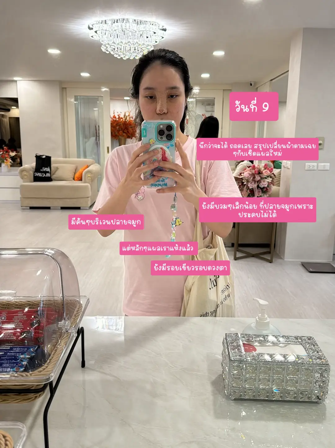 พรีชีพ ครั้งแรก เสริมจมูก full open+กระดูกหลังหู no spon | แกลเลอรีที่ ...