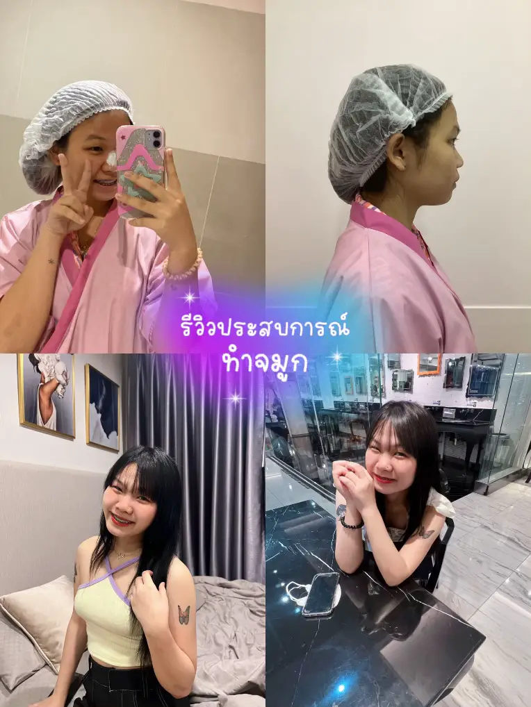 รีวิวประสบการณ์ ทำจมูก | แกลเลอรีที่โพสต์โดย Pream | Lemon8