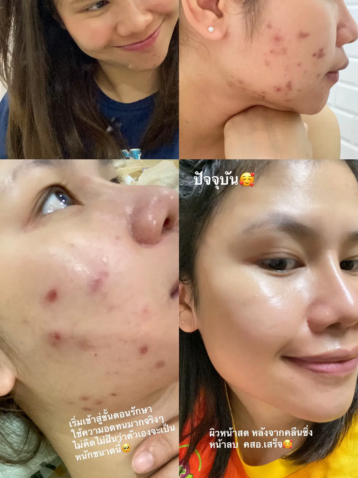 ลงทุนกับตัวเองดีที่สุด🥰 | แกลเลอรีที่โพสต์โดย Manow.p | Lemon8