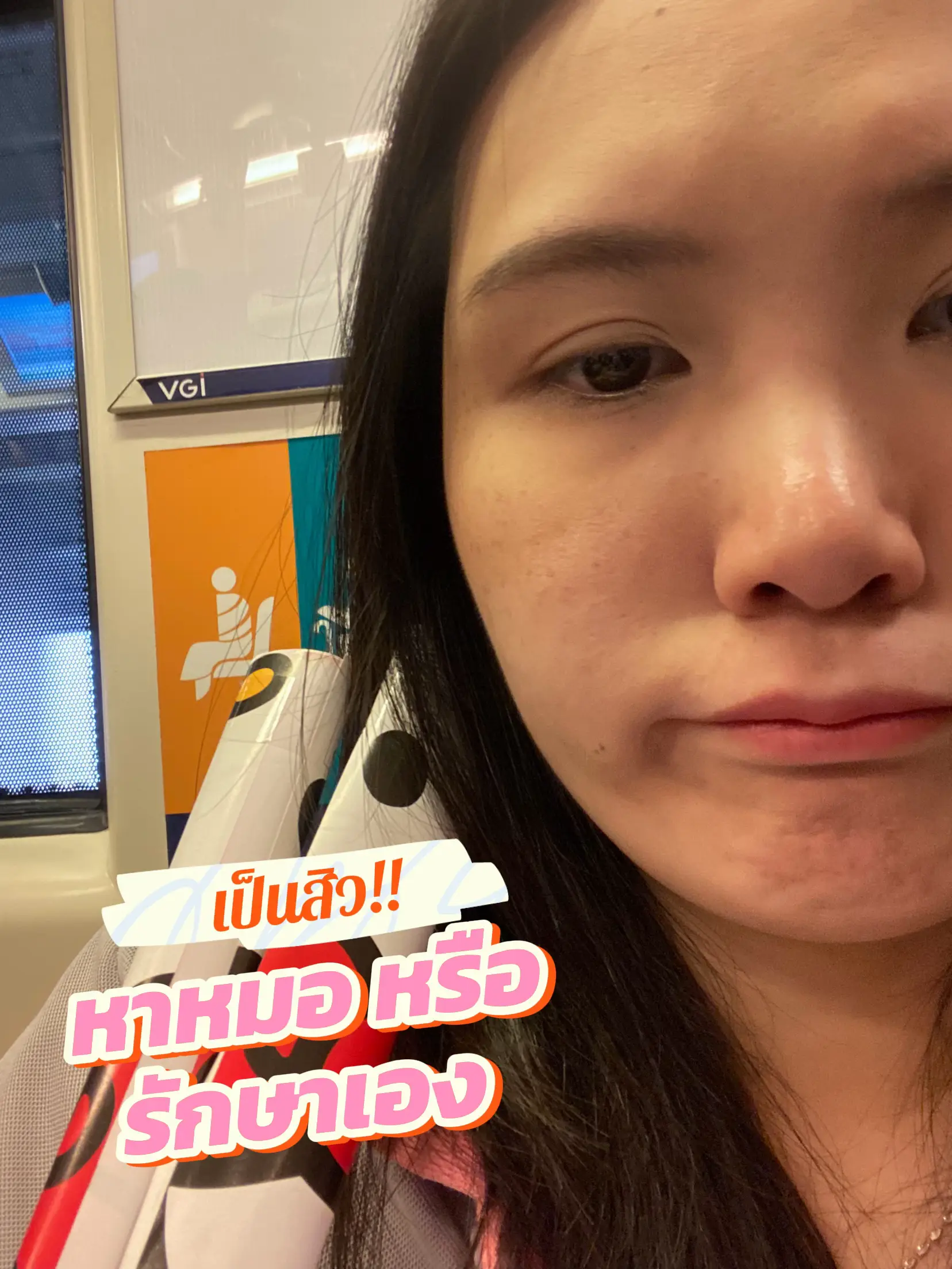 รักษาสิวกับหมอผิวหนัง กดสิวแบบเหมา300บาท กดเกินคุ้ม！ | แกลเลอรีที่โพสต์โดย xiaolifav. 🫶🏻 | Lemon8