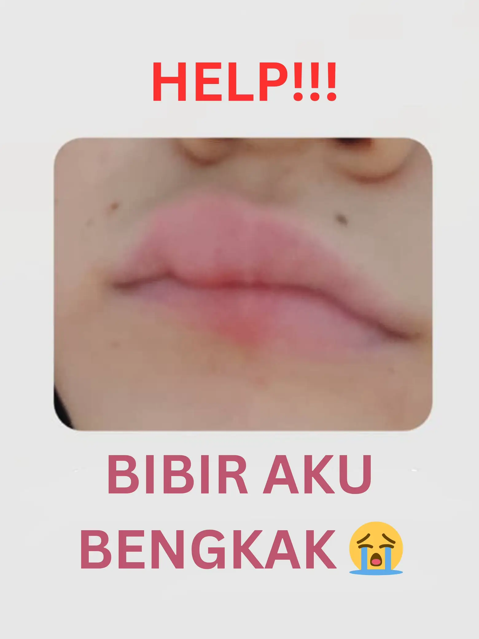 TOLONG 😭 BIBIR AKU BENGKAK 😱 | Galeri diposting oleh audreynatashaa ...