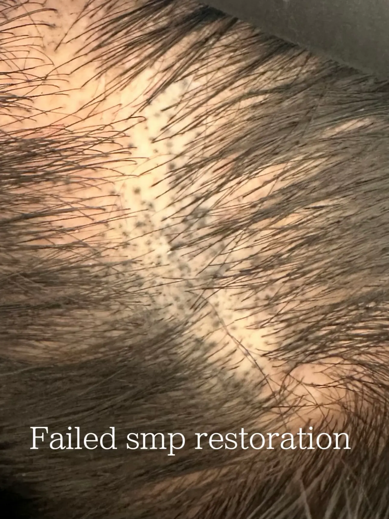 Failed smp restoration from other shop😔 | Gallery posted by Renée Kim ...