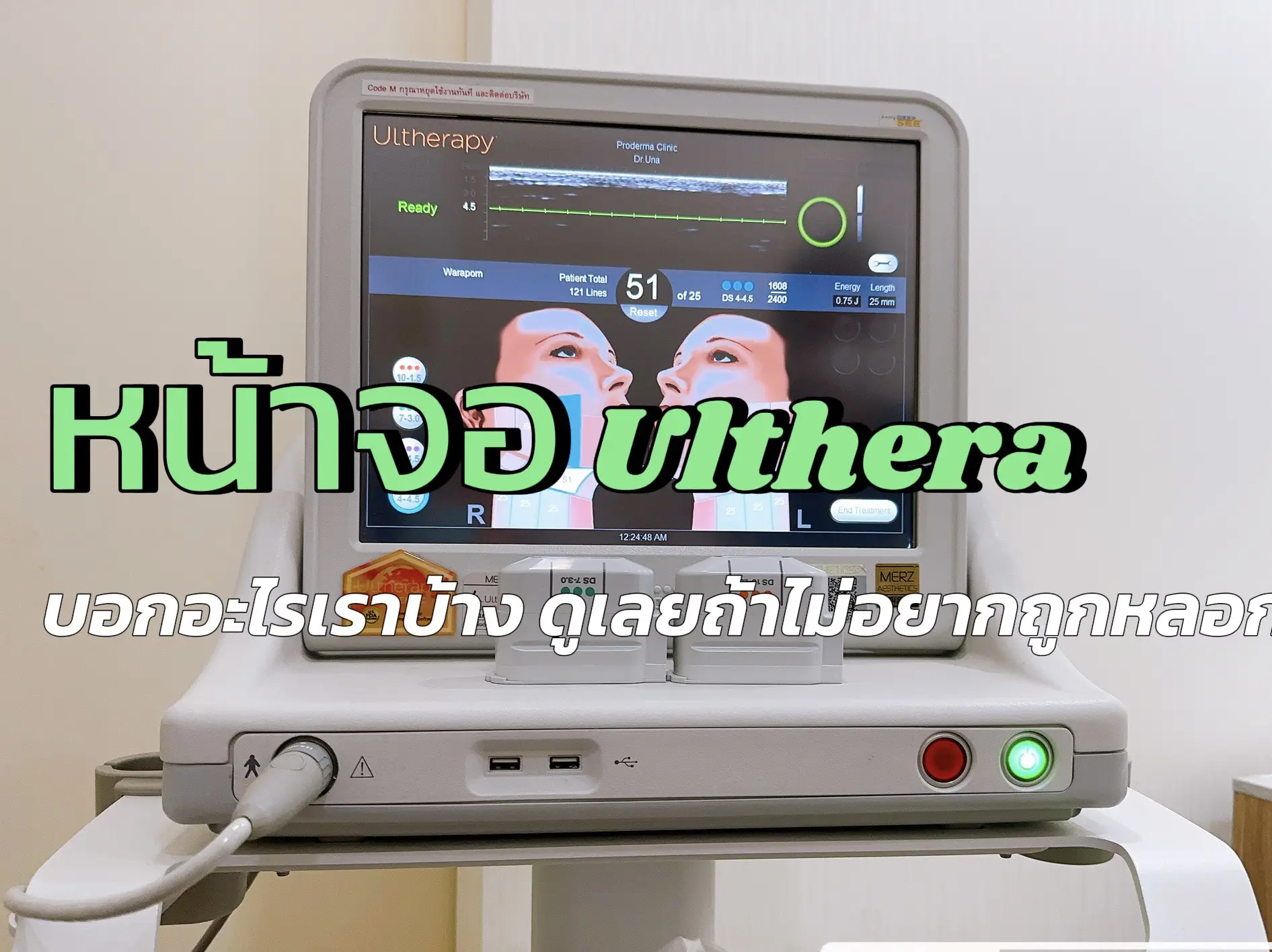 หน้าจอ Ulthera บอกอะไรเราบ้าง | แกลเลอรีที่โพสต์โดย ProDerMa | Lemon8