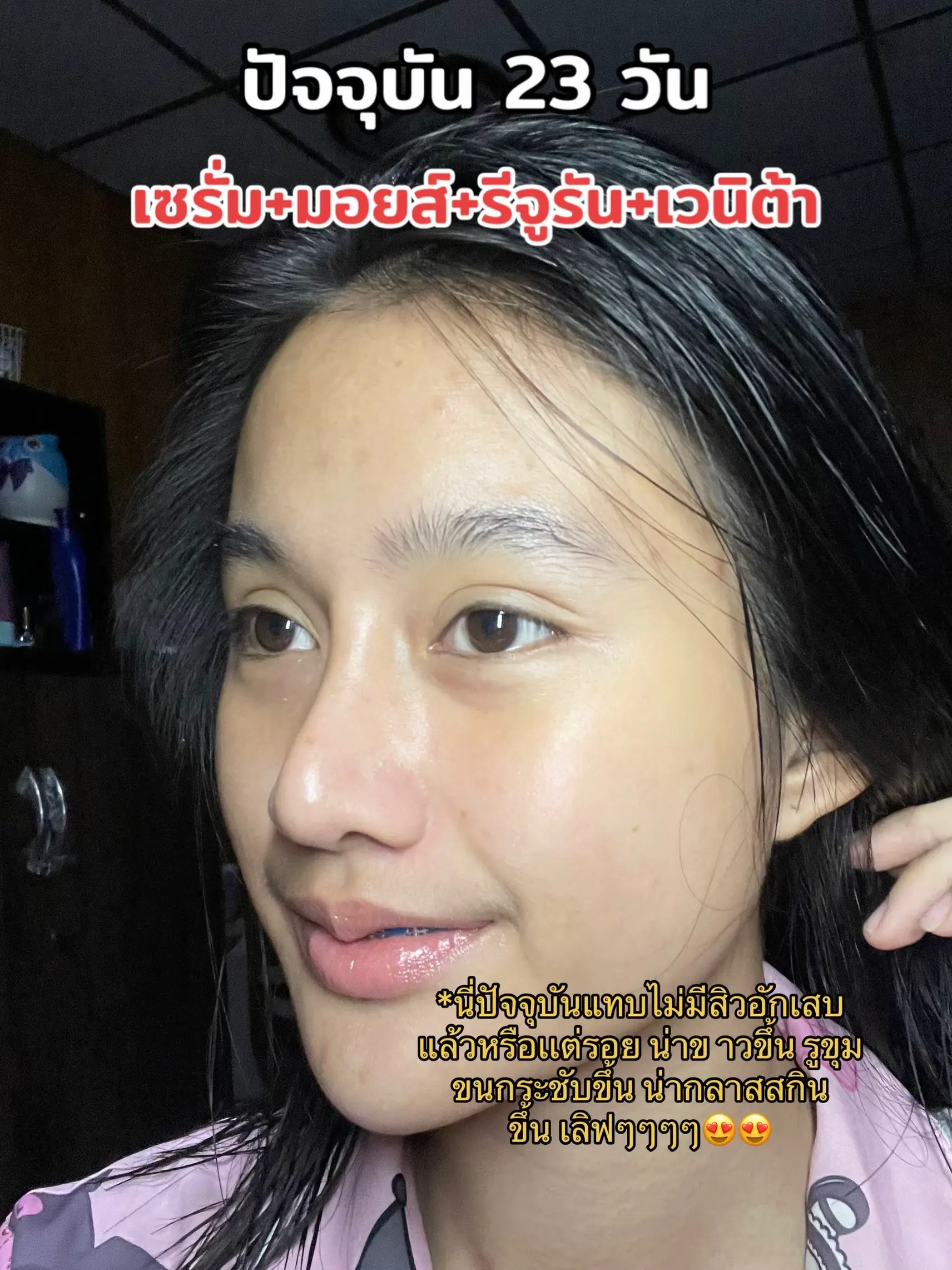 20 ไอเดียยอดนิยมเกี่ยวกับ ครีมรีจูรัน ดีไหม Pantip ในปี 2024