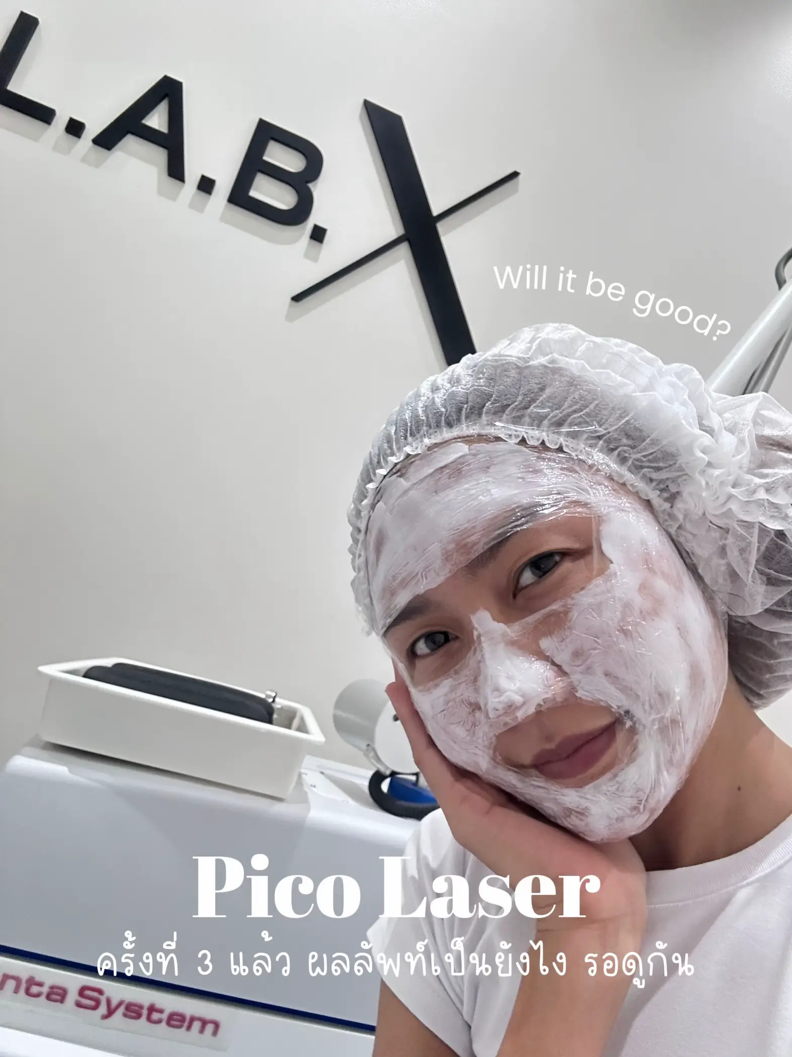 Pico Laser ครั้งที่ 3 แล้ว 😎 ดูแลผิวยังไงบ้าง | แกลเลอรีที่โพสต์โดย Aomiiz Aom | Lemon8