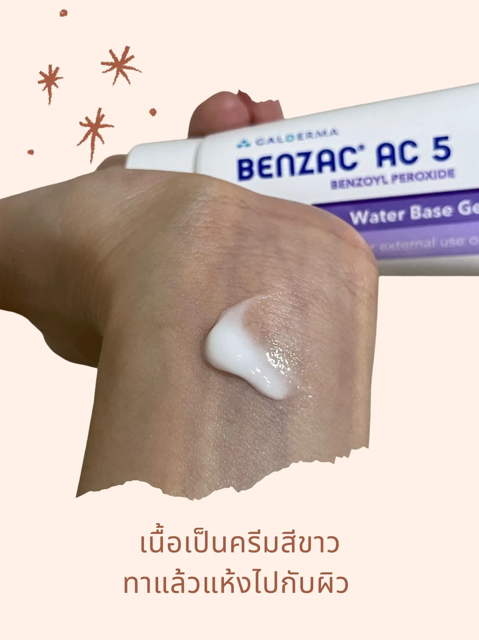 รักษาสิวอุดตันด้วยตัวเองด้วย Benzac | แกลเลอรีที่โพสต์โดย Sea_suppa ...