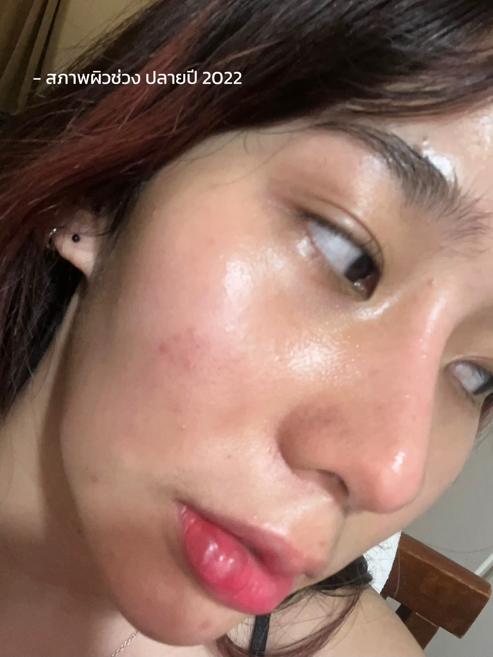 Skin care ที่ใช้แล้วคุณหมอชมหน้าใสมากจนใจฟู 💓 | แกลเลอรีที่โพสต์โดย νιωуѕ ♡ | Lemon8