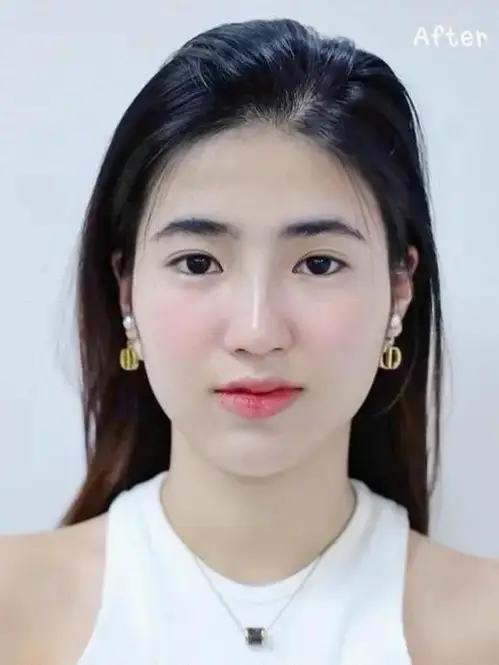 หน้าเรียวแบบลูกสาว LBC ด้วยโปร Size 3XL 👯‍♀️💙 | แกลเลอรีที่โพสต์โดย Lbc Beauty Club | Lemon8