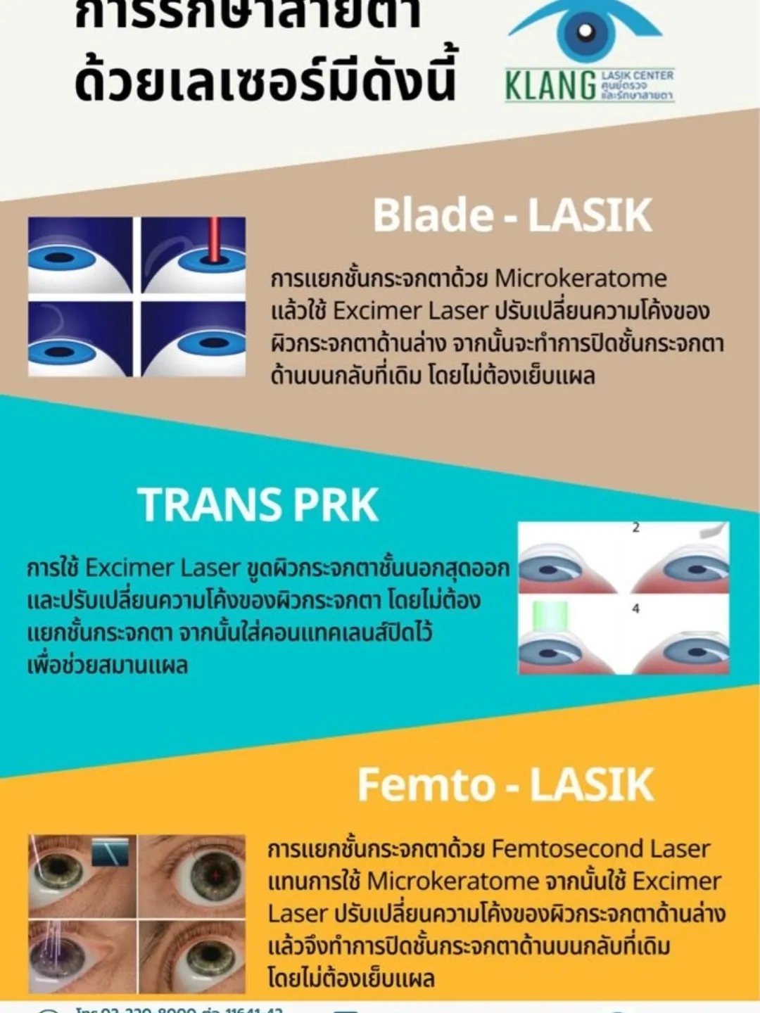 เล่าให้ฟัง ทำเลสิก แบบ Trans PRK ที่ รพ.กลาง | แกลเลอรีที่โพสต์โดย J. jellysaki | Lemon8