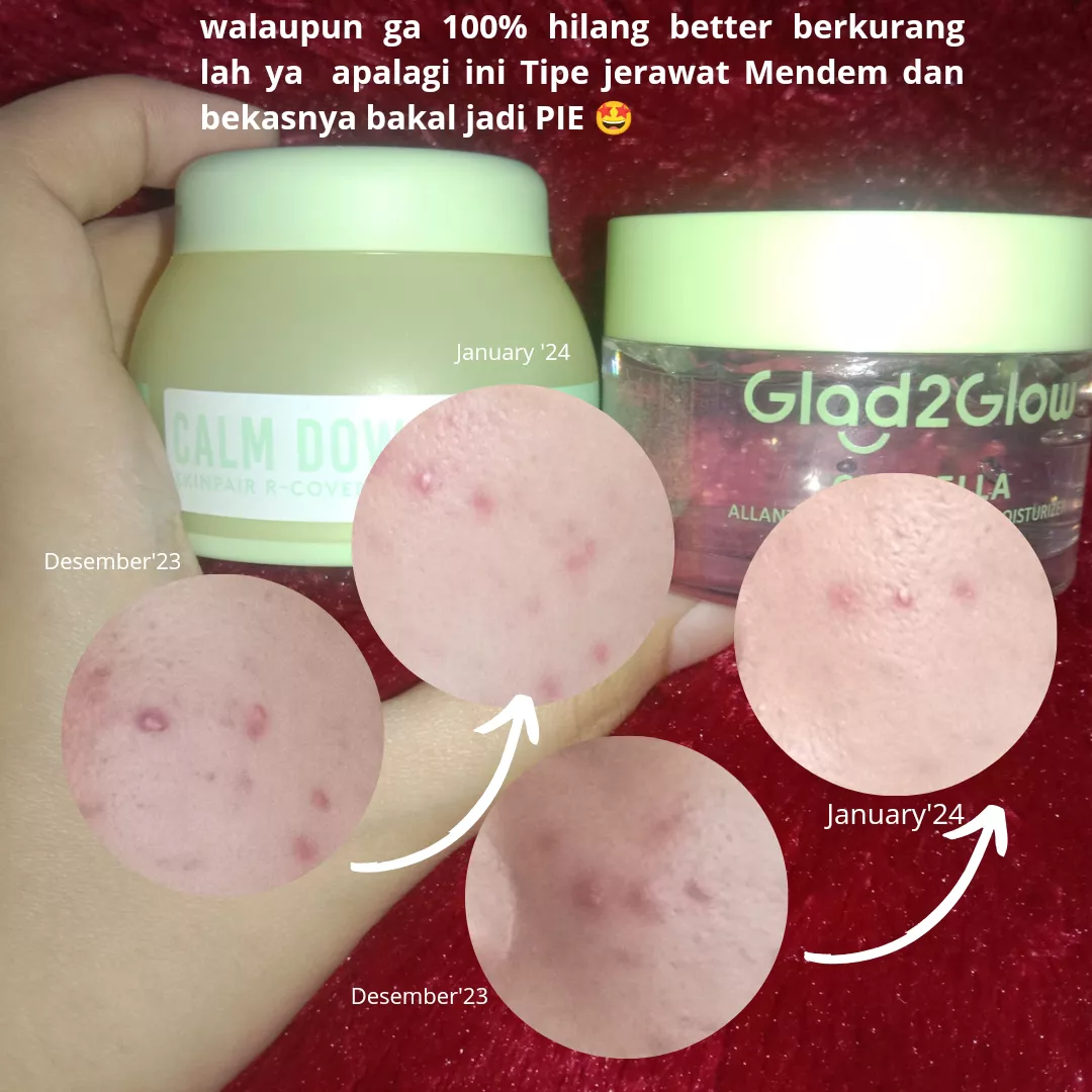 18 ide Perbedaan Moisturizer Glad2glow Ijo Dan Ungu teratas di 2024