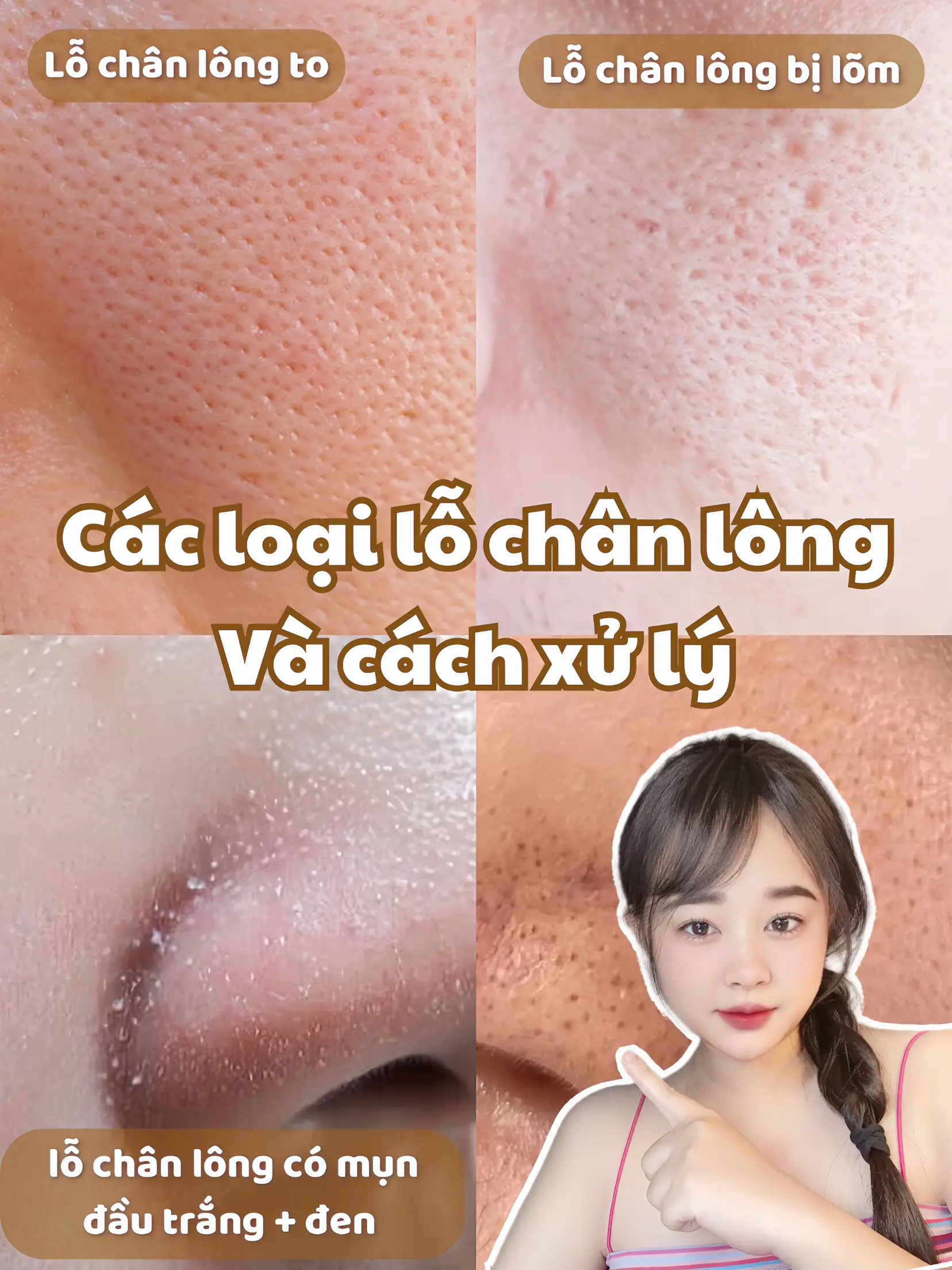 CÁC LOẠI LỖ CHÂN LÔNG VÀ CÁCH XỬ LÝ | Bộ sưu tập do Bảo Bối 🍀 đăng | Lemon8