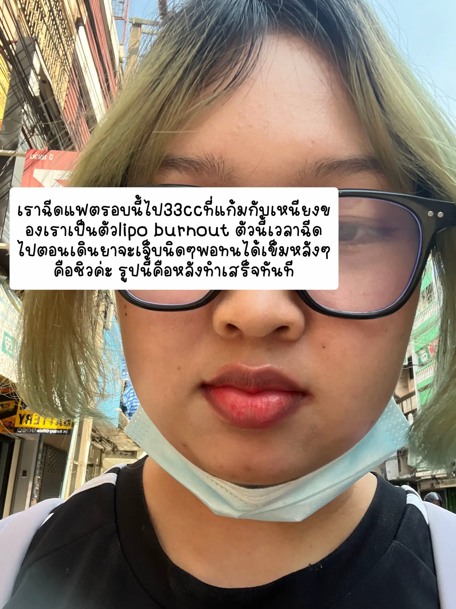 รีวิวแฟต33ccแบบไม่อวย‎ྀི🎀🪞🩰🦢 | แกลเลอรีที่โพสต์โดย P Peaw Peaw | Lemon8