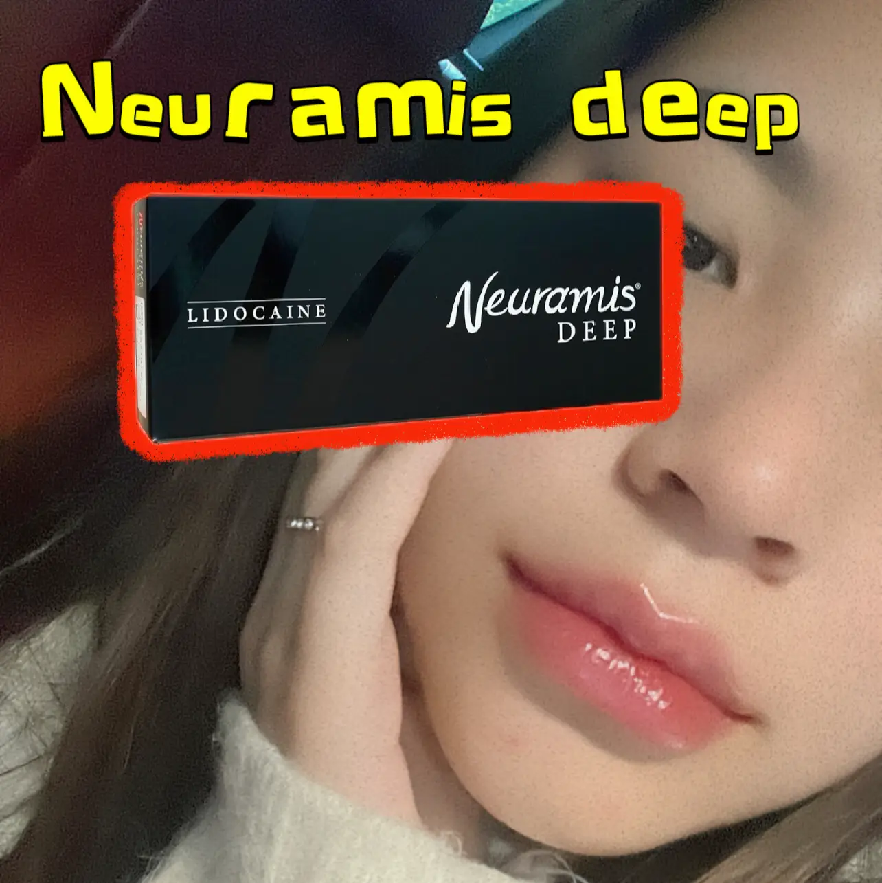 Neuramis deep - ฉีดปากครั้งแรก | แกลเลอรีที่โพสต์โดย Imma Ming | Lemon8