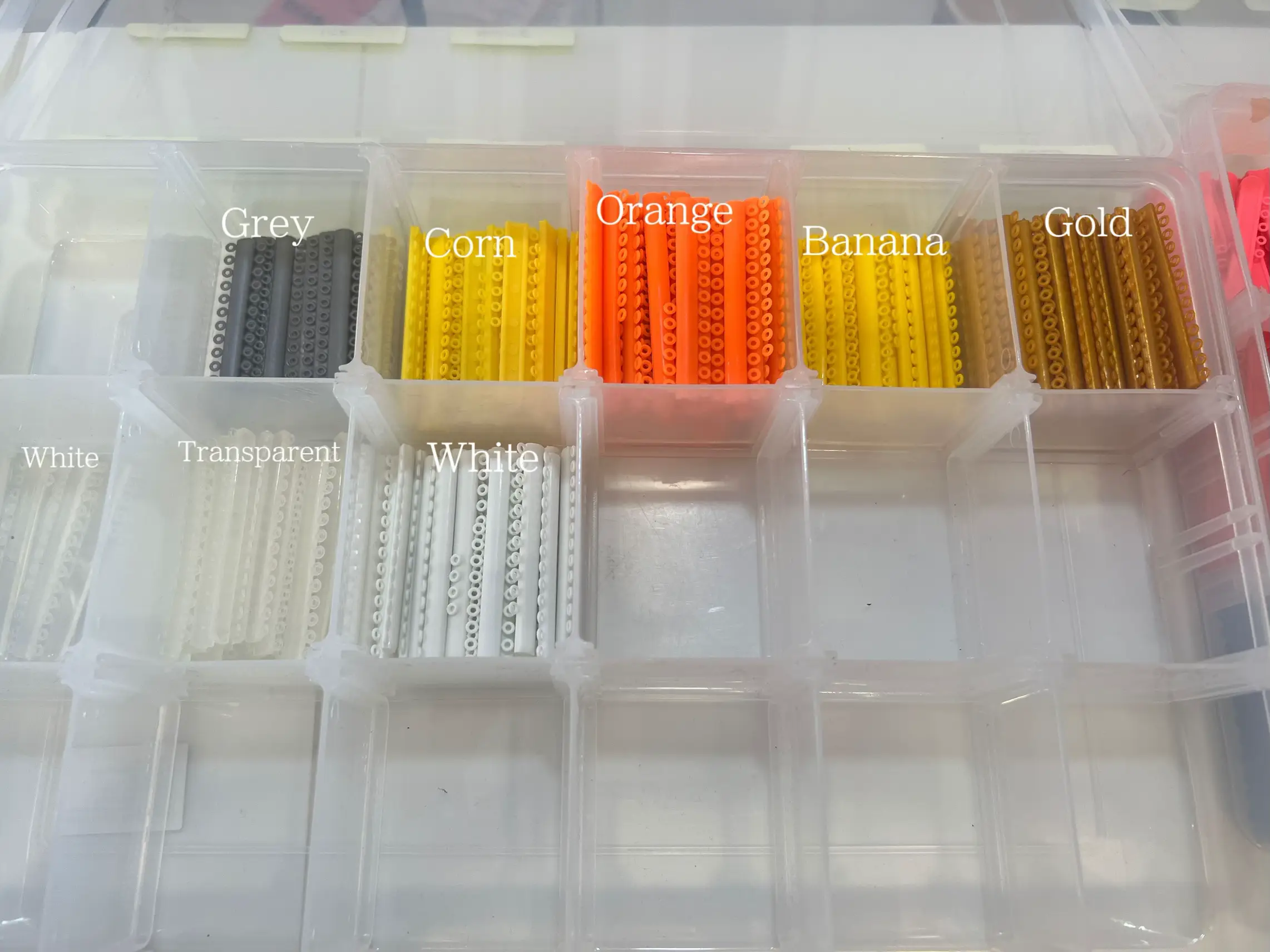 Rubber Band Braces Apa yang Cantik??? | Galeri disiarkan oleh Mimie ...