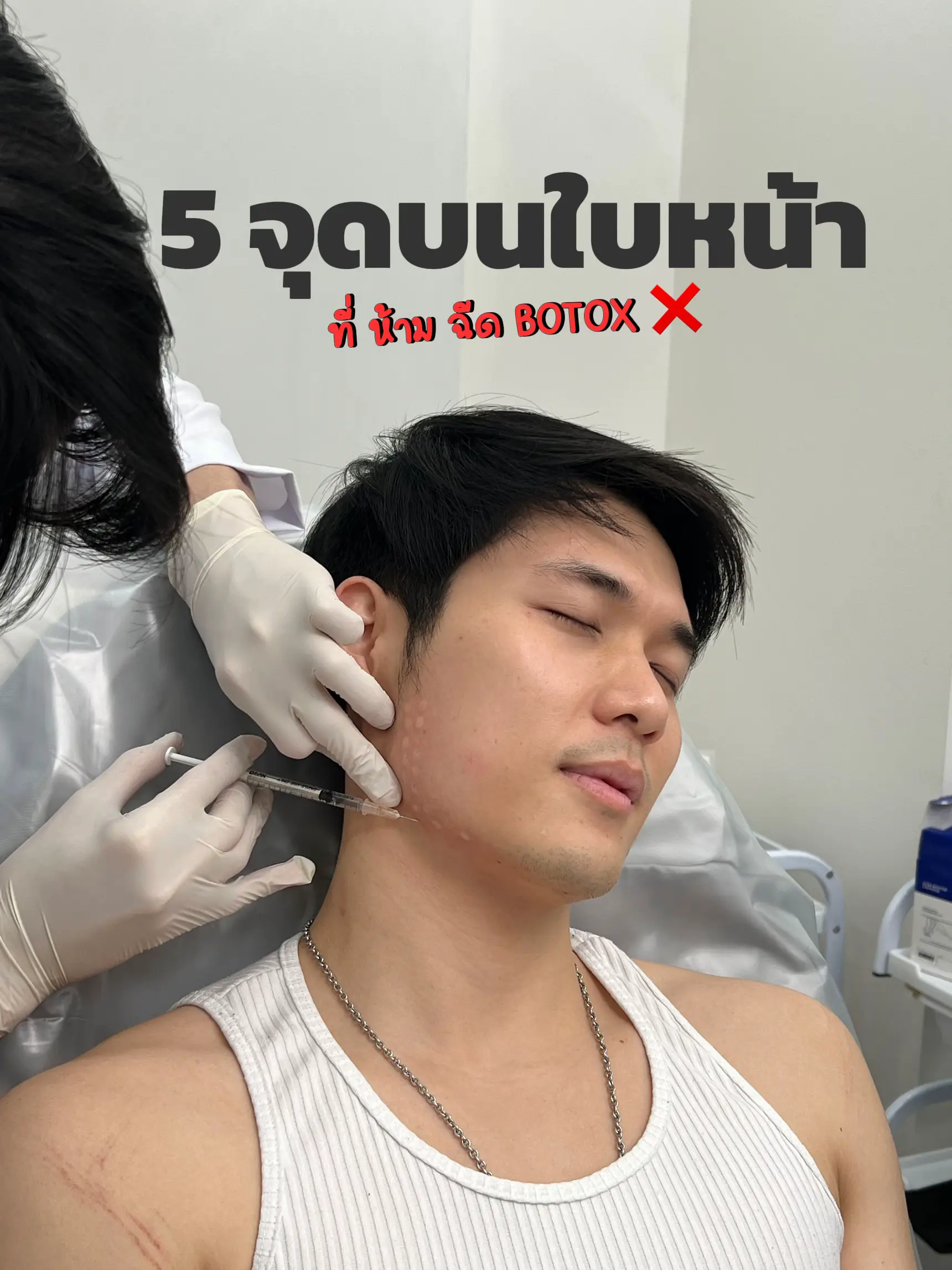 5 จุดบนใบหน้าที่ ห้าม ฉีด BOTOX | แกลเลอรีที่โพสต์โดย Labx clinic | Lemon8