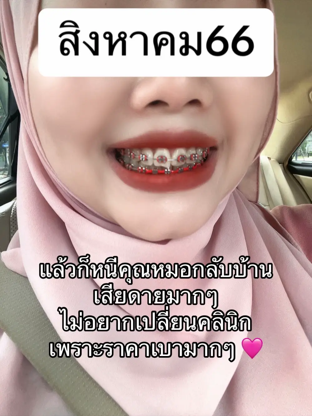 รีวิวจัดฟัน @ศาลายา นครปฐม | แกลเลอรีที่โพสต์โดย Thitikarn Boo | Lemon8