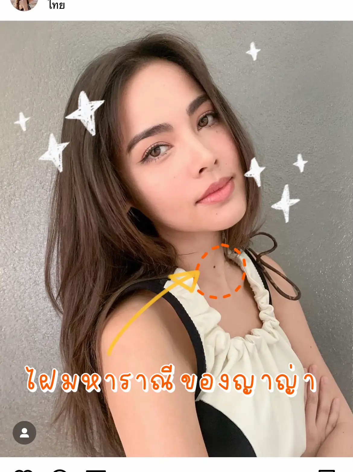 ไฝมหาราณี ขึ้นมาตอนฉัน 32 ขวบ | แกลเลอรีที่โพสต์โดย Ma riam | Lemon8