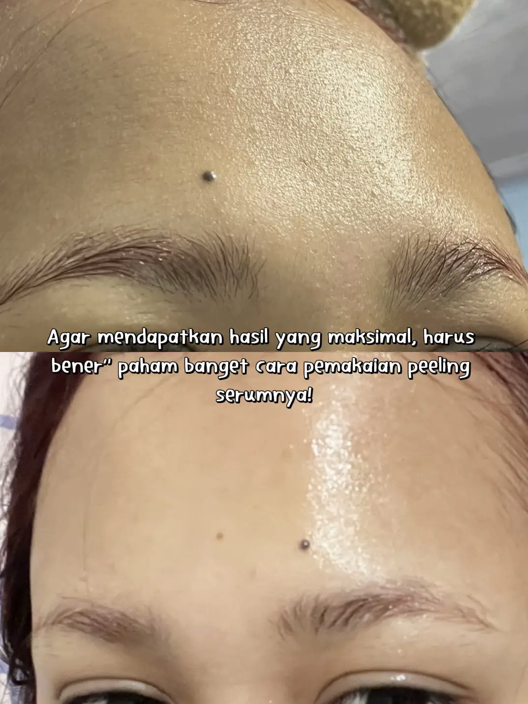 18 ide Cara Pakai Elformula Intensive Peeling Solution teratas di 2024