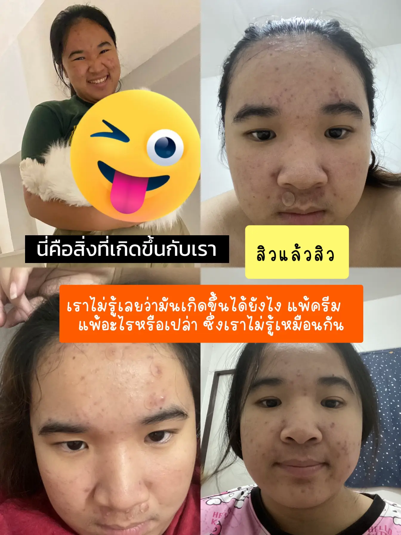 วันนี้เราจะมารีวิว ที่เกิดขึ้นกับตัวเอง | แกลเลอรีที่โพสต์โดย Eing | Lemon8