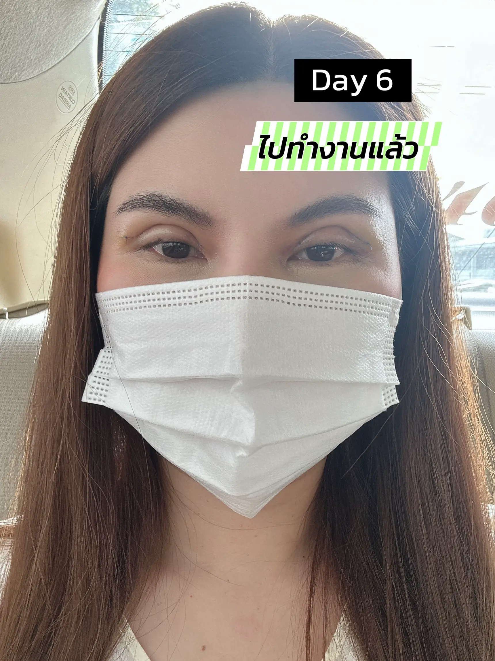 ศัลยกรรมในวัย 40 | แกลเลอรีที่โพสต์โดย Janry Jan | Lemon8