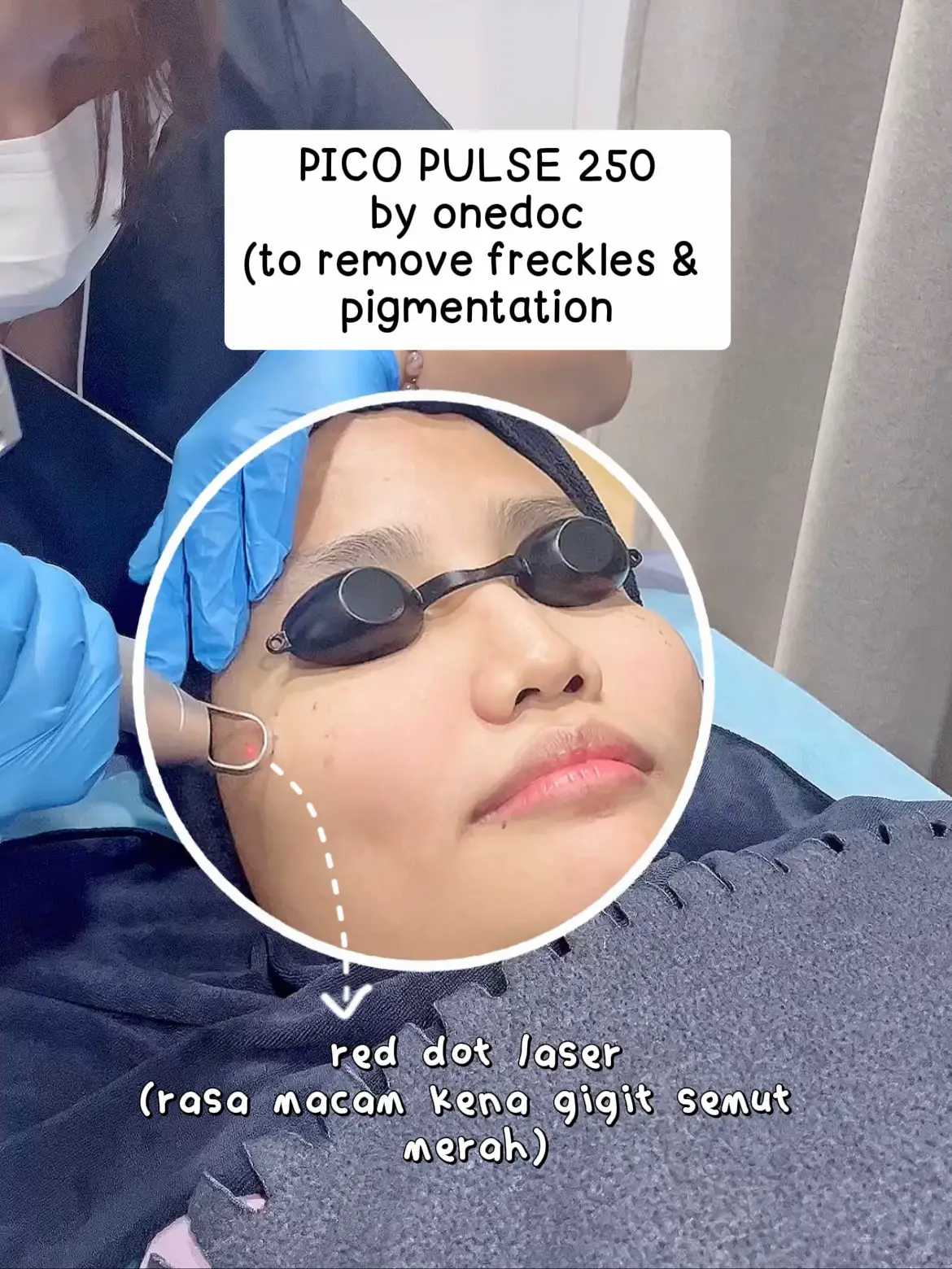 OMG!! PICO PULSE TAK SAKIT KE? | Galeri disiarkan oleh imperfectpiqa ...