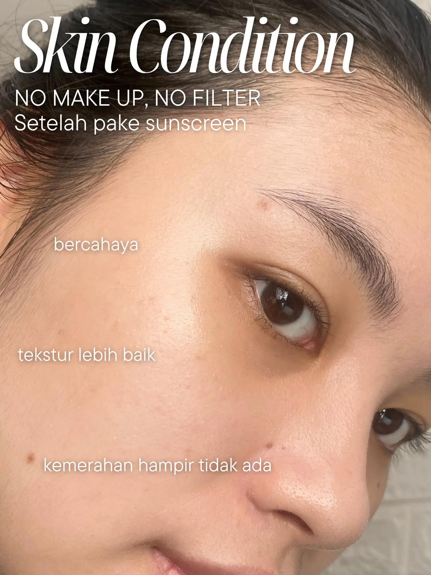 Zat-zat Ini Bikin Skin Barrier Aman Sentosa | Galeri diposting oleh ...