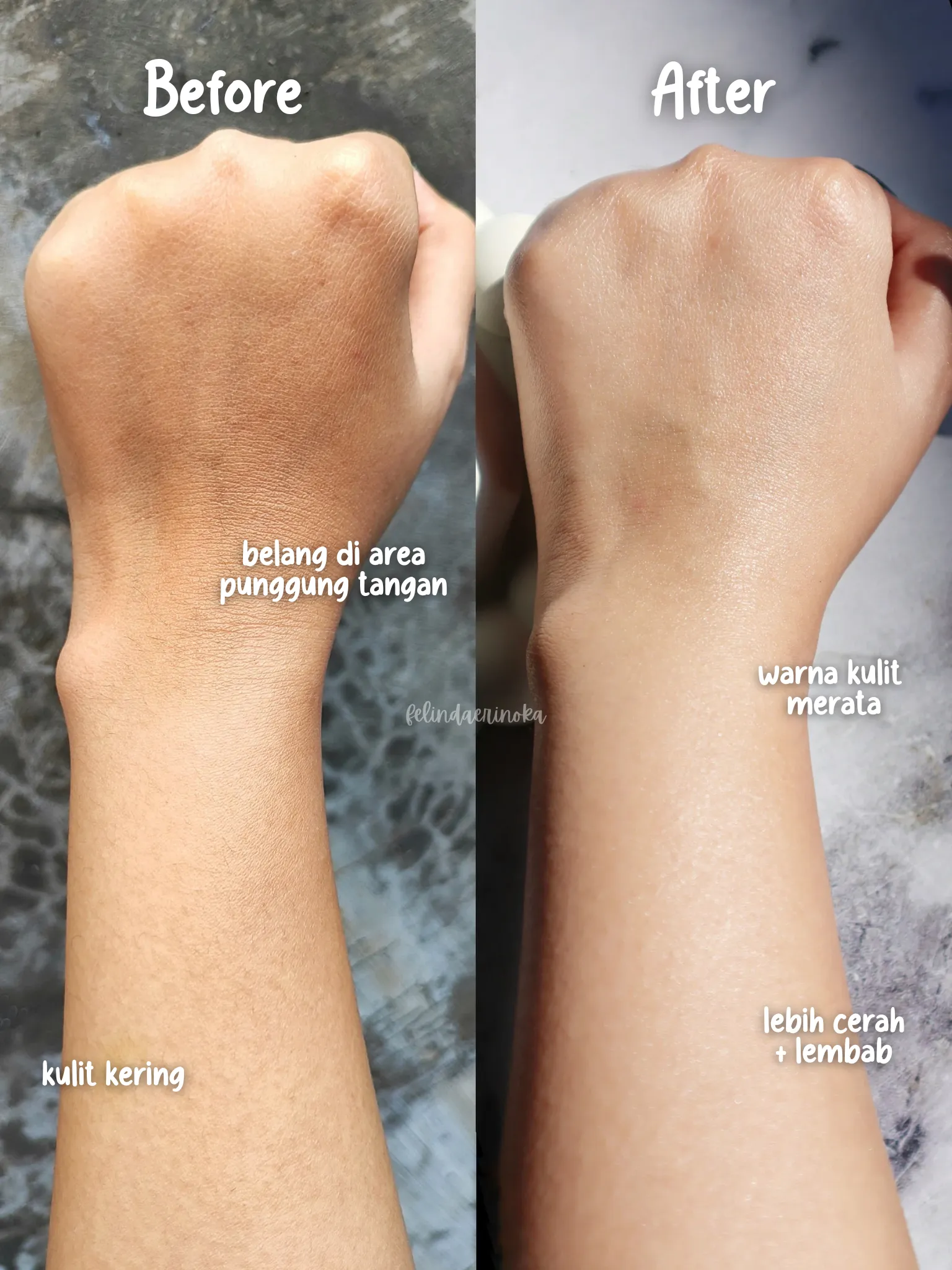 Kulit Tangan Belang? Cobain Tips Ini! 🤩👍🏻 | Galeri diposting oleh Felin ...