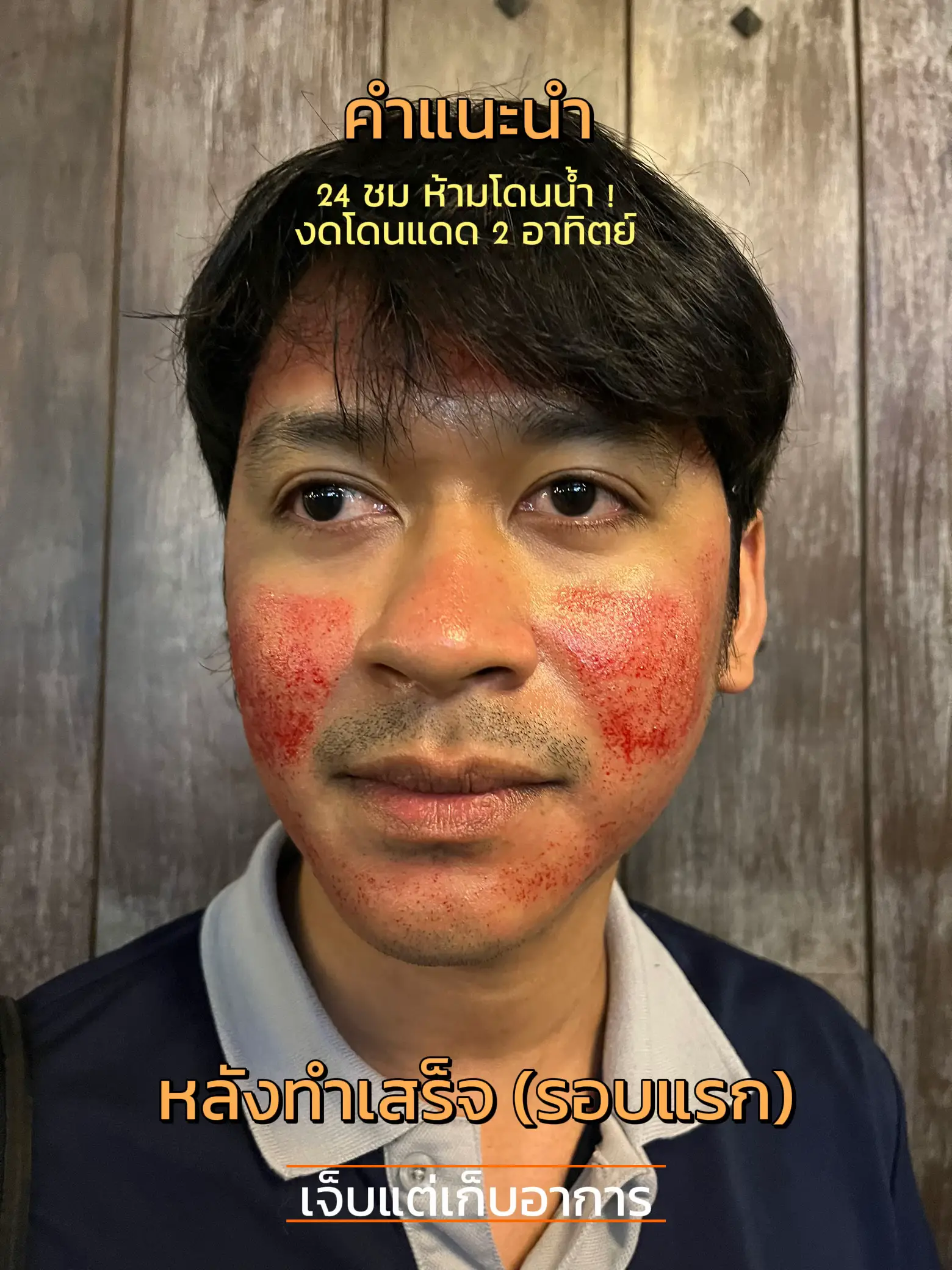 Review ทำ Pico ที่ Prime Aesthetics | แกลเลอรีที่โพสต์โดย Hello._.noon ...