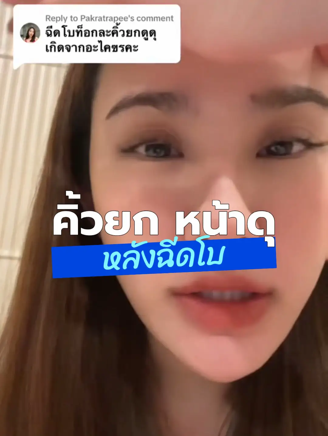 คิ้วยก หน้าดุ หลังฉีดโบ | วิดีโอที่เผยแพร่โดย Thewika T. | Lemon8