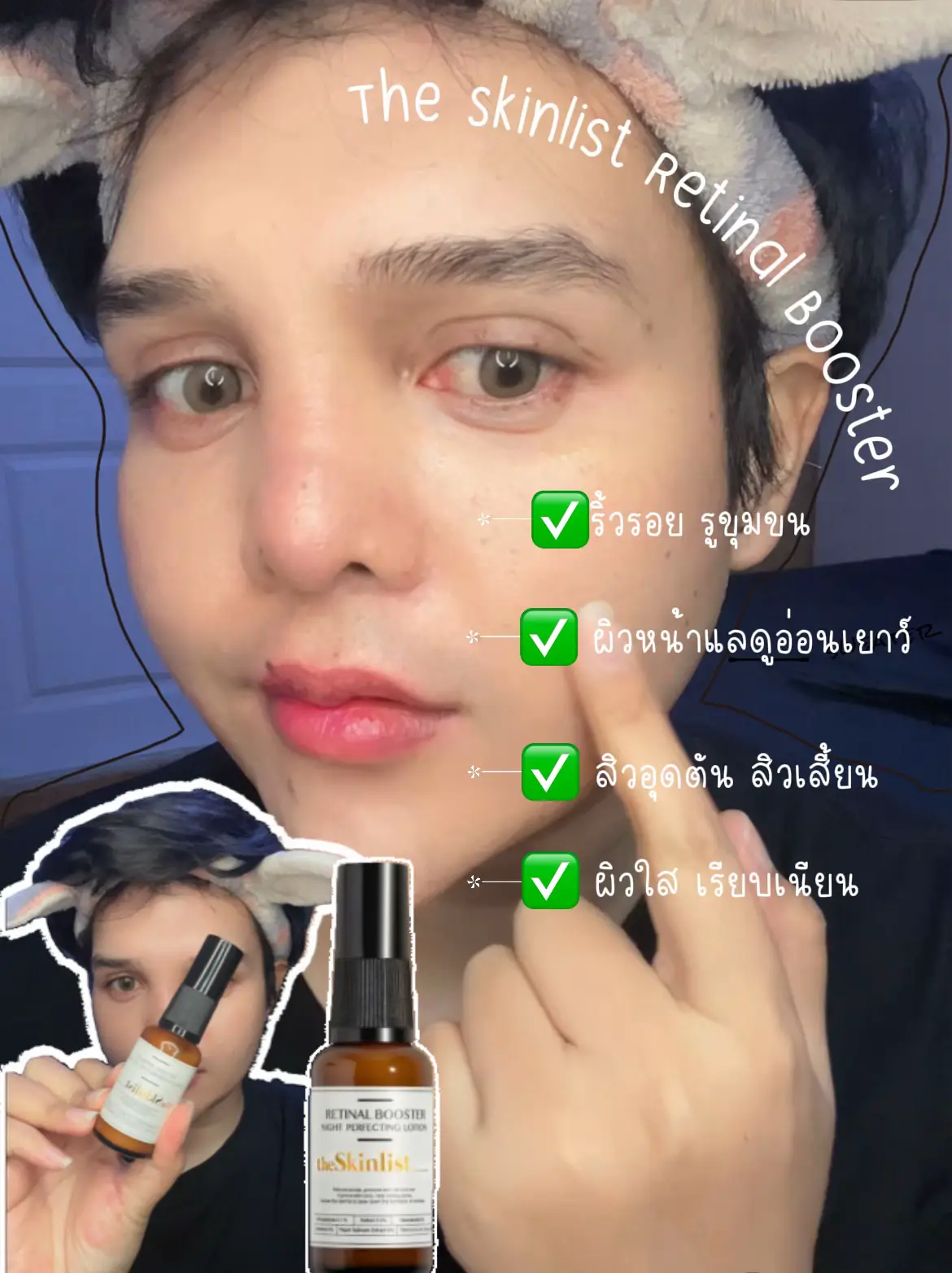 The Skinlist ดูแลปัญหาผิวหลายประการ | แกลเลอรีที่โพสต์โดย Si_Sindy | Lemon8