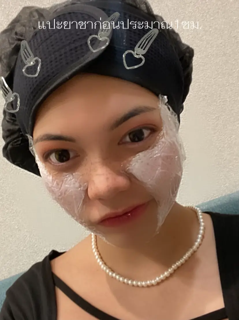 รีวิว HIFU ยกกระชับหน้าที่ Mia Clinic🖐🏻 | แกลเลอรีที่โพสต์โดย superkwann 🎀⭐️ | Lemon8