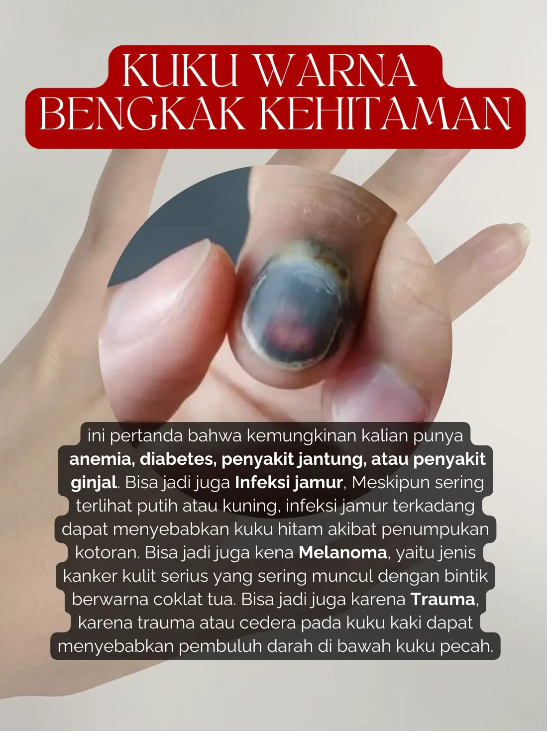 WARNA KUKU TUNJUKKAN KONDISI KESEHATANMU!⚠️😱 | Galeri diposting oleh Charmine🤍 | Lemon8